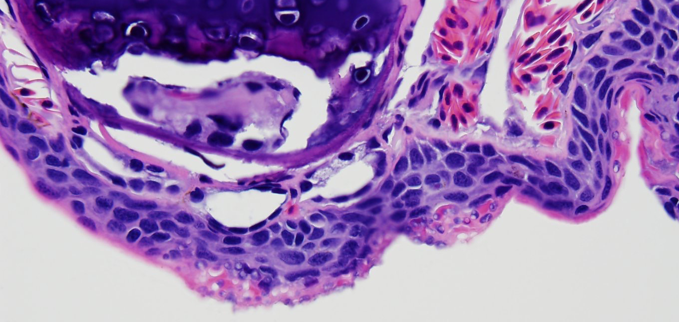 The Pathogen | UTIA Bsal Project